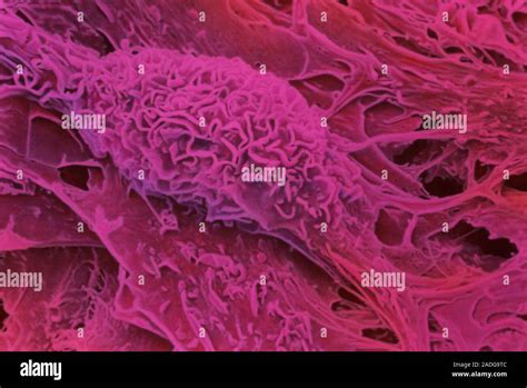 Embryonic Stem Cells Coloured Scanning Electron Micrograph Sem Of Cultured Mammalian
