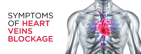 How To Check Heart Blockage At Home Wdxo