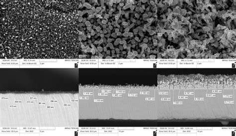 A Dual‐layered Anode Buffer Layer Structure For All Solid‐state Batteries Lu 2025