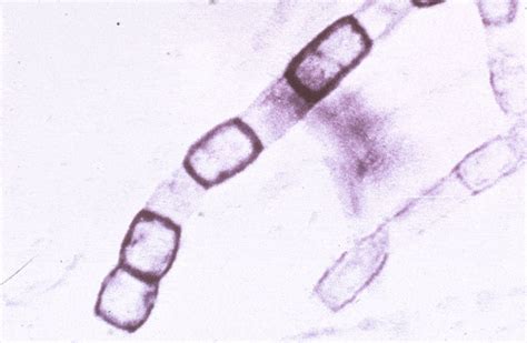 Dimorphic Fungi And Their Properties Learn Microbiology Online