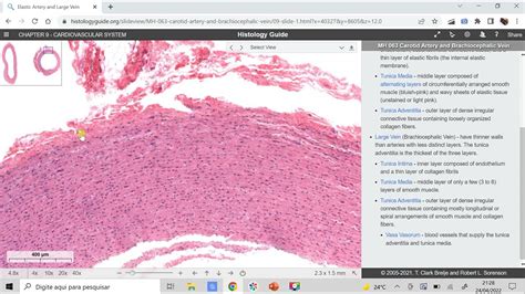 Histologia Das Artérias De Grande E Médio Calibre Lâminas Escaneadas