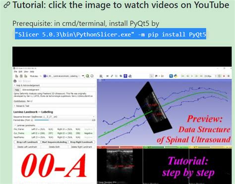 Add SlicerIGSpineDeformity Extension By SenonETS Pull Request Slicer ExtensionsIndex