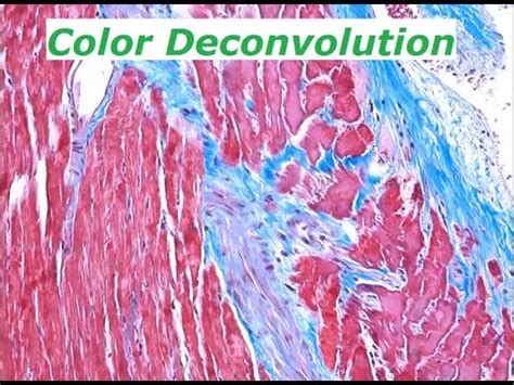 Separating Colors In Light Microscopy Images Color Deconvolution In ImageJ FIJI YouTube