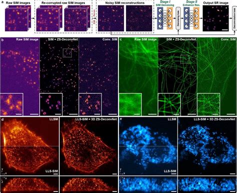 Nature Communications Zero Shot Learning Enables Instant Denoising And