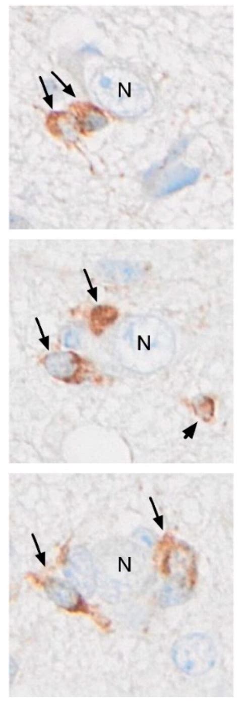 Cancers Special Issue Graph Neural Networks In Cancer Research