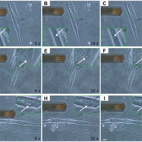 Fluorescent Dye Influx Fm1 43 In Human Myotubes Harboring Dysf