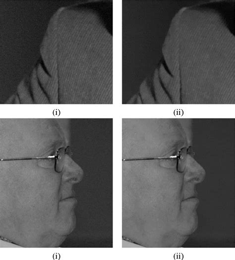 Figure 1 From Application Of Particle Filtering To Image Enhancement