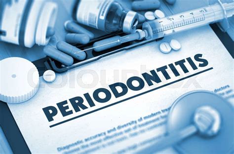 Periodontitis Printed Diagnosis With Blurred Text Periodo Colourbox