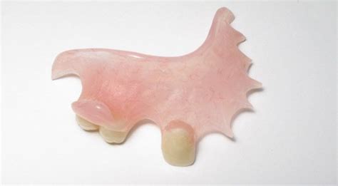 Partial Dentures Denture Services Edmonton