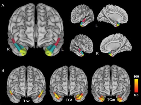 Figure 1 From Connectivity Based Parcellation Of The Human Temporal