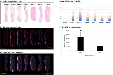 In Vitro Evaluation Of The Percutaneous Absorption Of Progesterone In Anhydrous Permeation