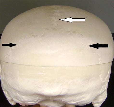 Posterior View Of A Typical Skull White Arrow Indicates The Sagittal