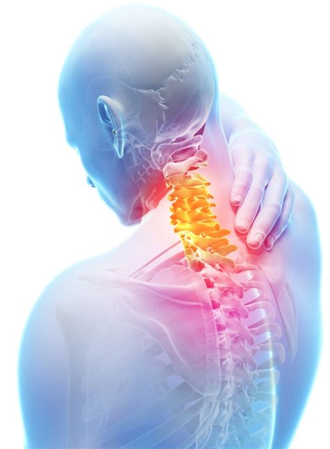Cervical Radiculopathy Icd 9 Code Medical Billing And Coding Online