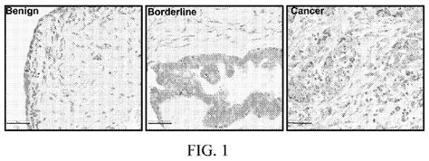 Combination Cancer Therapies Eureka Patsnap