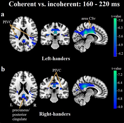 Visualisation Of Results From Source Localization Analyses Contrasting