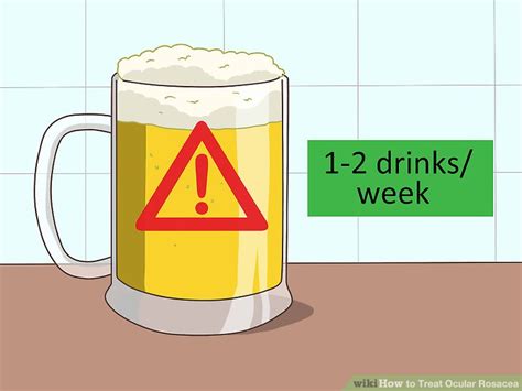 How To Treat Ocular Rosacea Steps With Pictures WikiHow