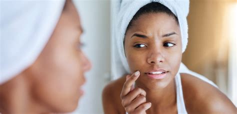 Hormonal Acne Why You Have It And What To Do About It