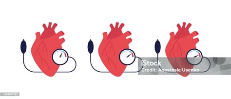 혈압 인포 그래픽 벡터 평면 그림 세트입니다 흰색 배경에 격리된 모니터에 낮은 정상 높은 압력의 심장 해부학 모양 의료 심장학을위한 디자인 혈압계에 대한 스톡 벡터 아트 및