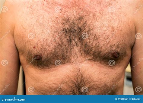 Secondary Sex Characters Of Men Stock Image Image Of People Girl