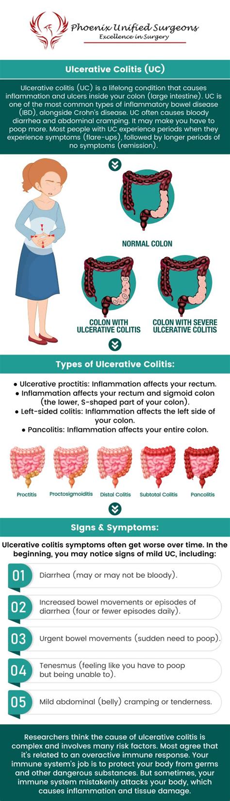 Ulcerative Colitis Surgery Specialist Near Me In Phoenix Az