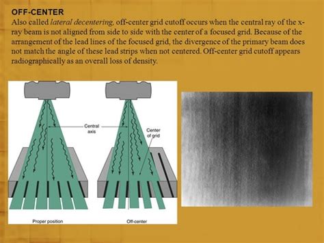 Types Of Grid Cut Off Grid Review Questions Radiographic Grids