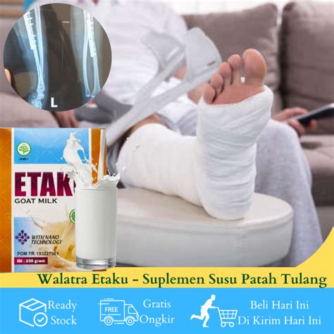 Suplemen Susu Patah Tulang Obat Patah Tulang Akibat Jatuh Kecelakaan Tulang Patah Tulang