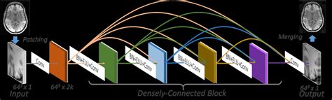 Framework Of The Proposed 3d Densely Connected Super Resolution Download Scientific Diagram