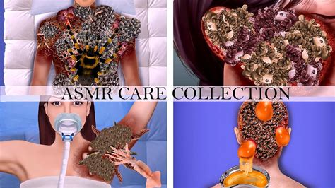 Asmr Care Collection Asmr Animation Treatment 2d Animation