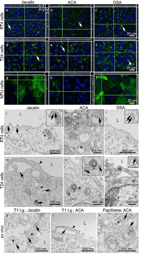 Lectin Conjugates Targeting Cancerous Urothelial Cells For Improved Bladder Cancer Treatment