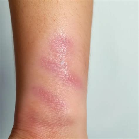 premium ai image visualizing skin conditions a medical illustration