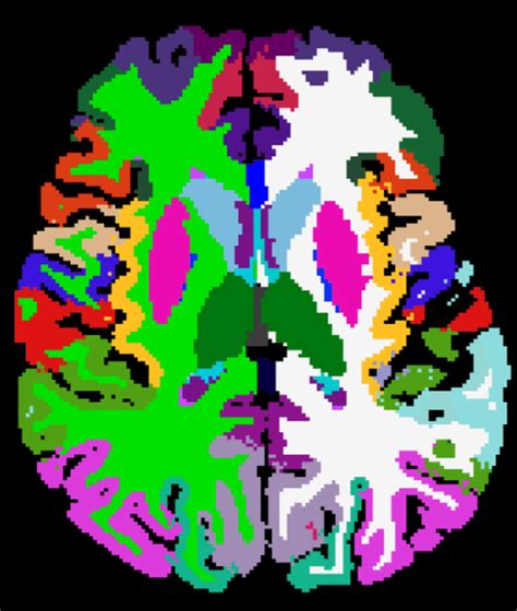 Post Processed T1w Image Showing Cortical Segmentation Using Freesurfer