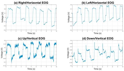 Eog Signal Classification With Wavelet And Supervised Learning Algorithms Knn Svm And Dt