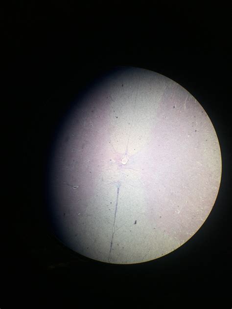 Spinal Cord Cross Section Diagram Quizlet