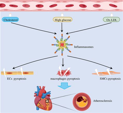 Multiple Risk Factors Contribute To Atherosclerosis By Inducing