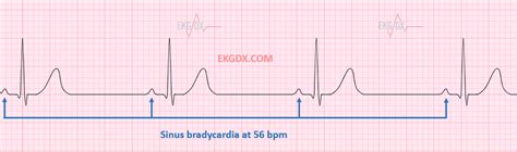 Ekgdx The New Era Of Ekg Learning
