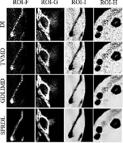 Figure 1 From Spectral Ct Image Domain Material Decomposition Via Sparsity Residual Prior And