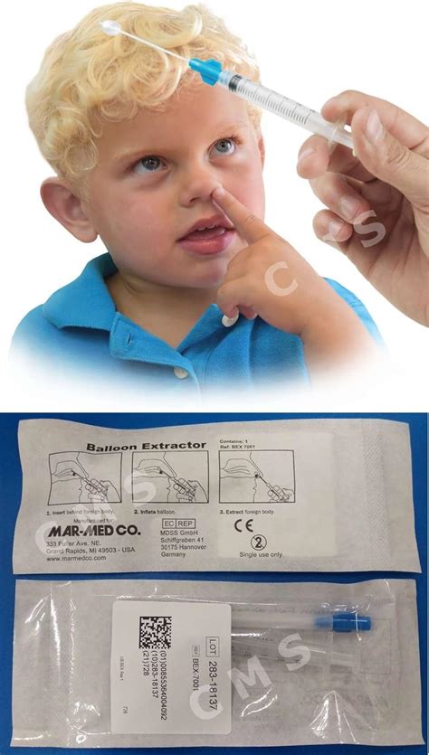 Mar Med Balloon Extractor Nasal Nose Foreign Bodies Nepal Ubuy