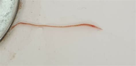 Bright Red Worm In Washbasin Is A California Blackworm All About Worms