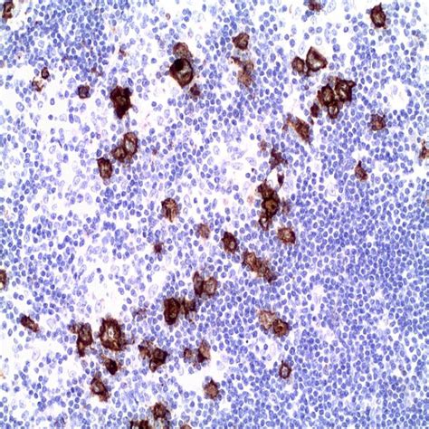 Epstein Barr Virus Eber Cish Detection Kit Incl Detection System Sama Tashkhis Aria