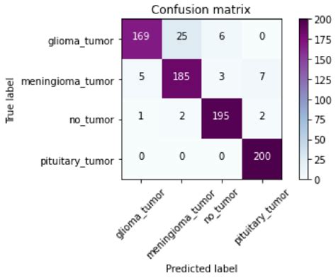 Bayesian Depth Wise Convolutional Neural Network Design For Brain Tumor Mri Classification