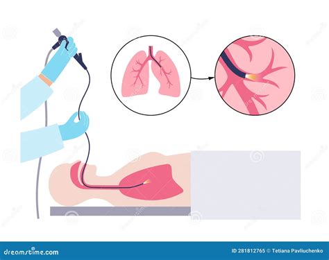 Bronchoscopy Respiratory System Emphysema Endoscopy Human Lung Examination Bronchoscopy Icon