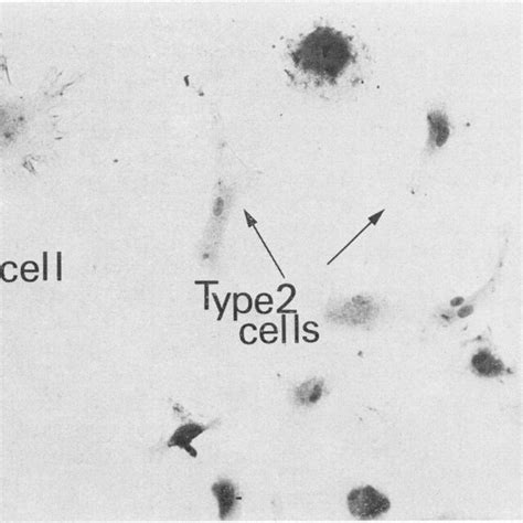 Small Rounded Basophilic Cells Type 1 Grown From Control Filter