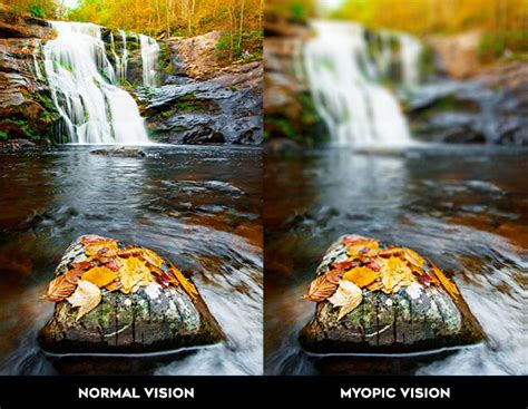 Myopia Nearsightedness Trinidadeyehospital