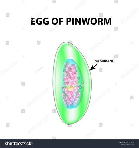 Egg Pinworm Structure Egg Pinworm Infographics Stock Vector Royalty