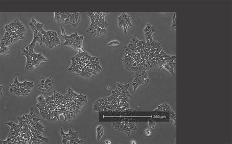 How To Measure Cell Confluency