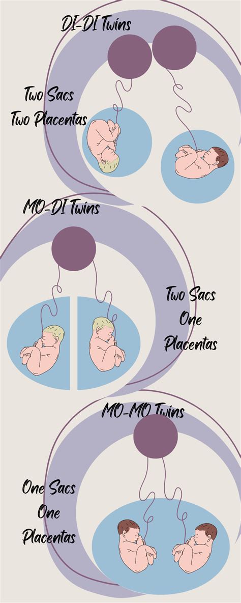 Twin Types — High Country Doulas