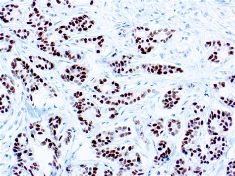 Estrogen Receptor Er Sp1 Antibody Diagnostic Biosystems Dbs
