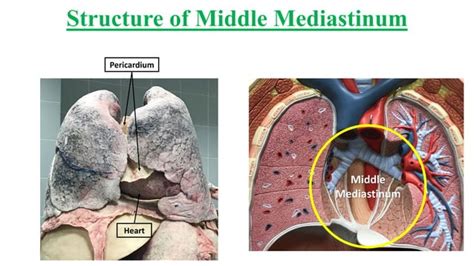 Anatomy Middle Mediastinum Pdf Lung And Respiratory Health Diseases And Conditions