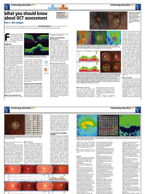 Oct Disc Analysis For Glaucoma Detection Pdf Retina Glaucoma