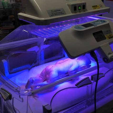 Brain Magnetic Resonance Imaging Scans Of The Patient At 1 Year Of Age